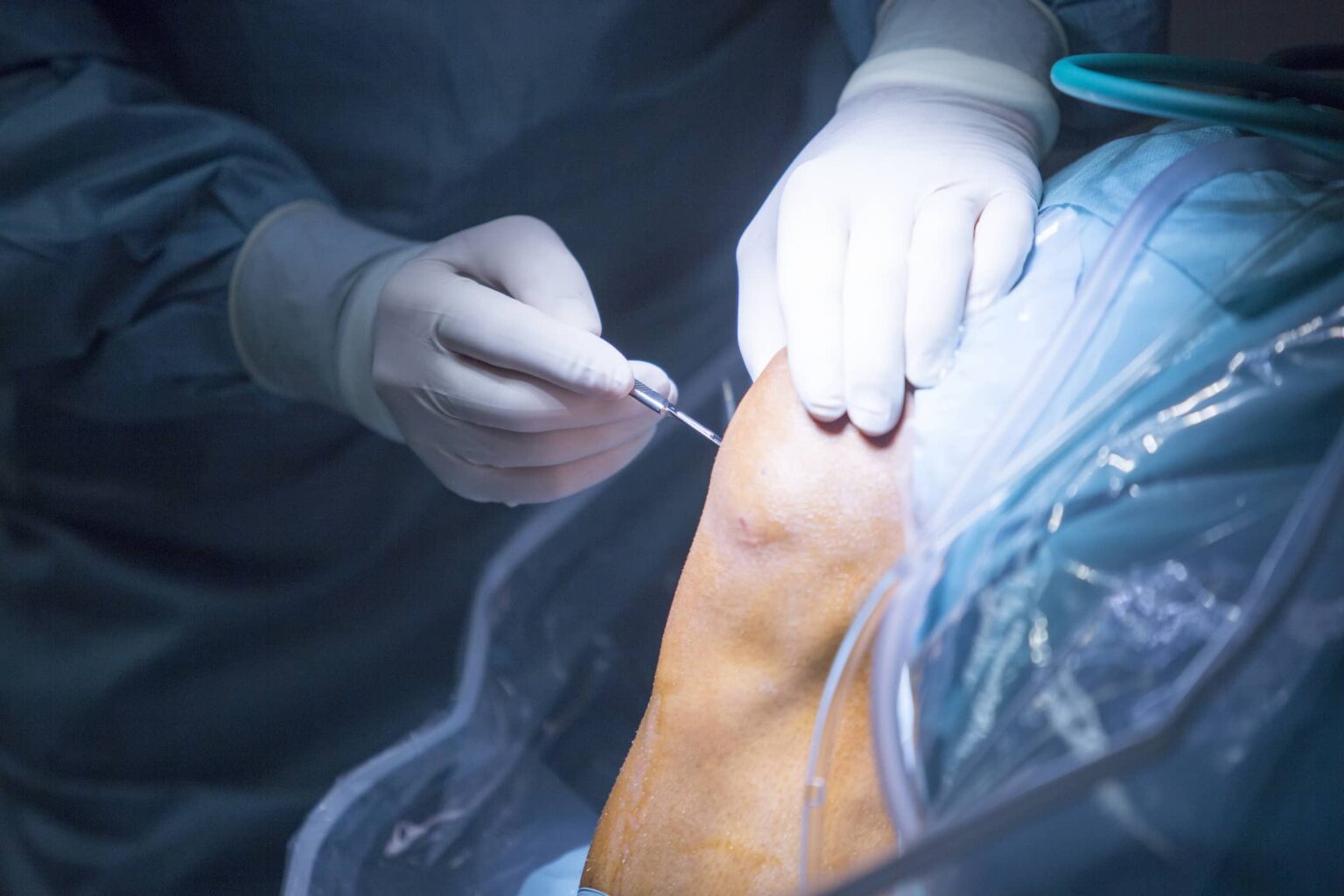 What Happens If a Fracture Is Left Untreated or Heals Improperly ...